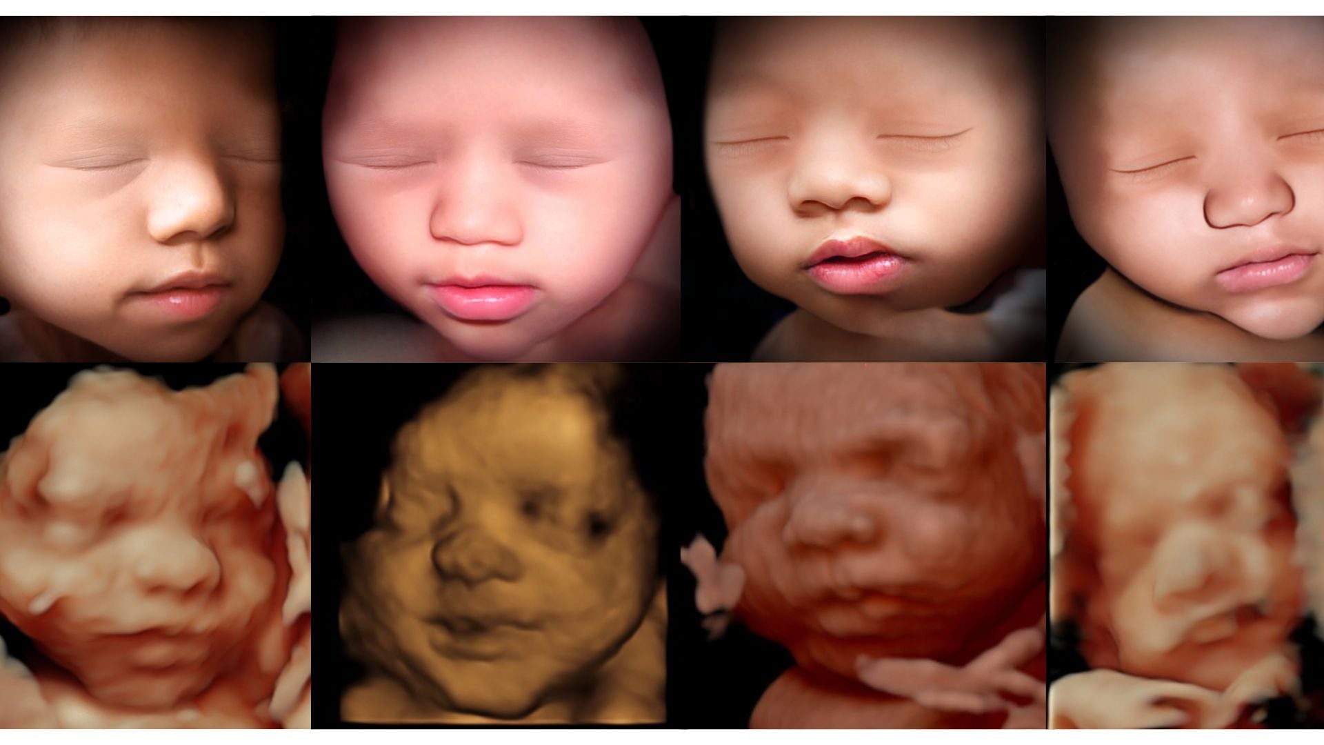8K Ultrasound Imaging Service Babytures 8k-ultrasound-imaging-service-babytures