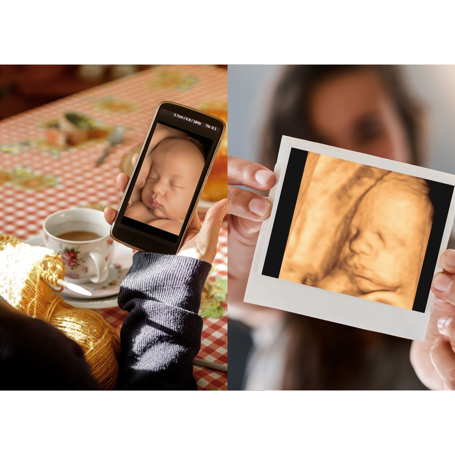 8K Ultrasound Imaging Service – Babytures
