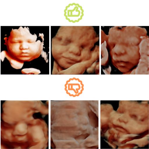 8K Ultrasound – Babytures