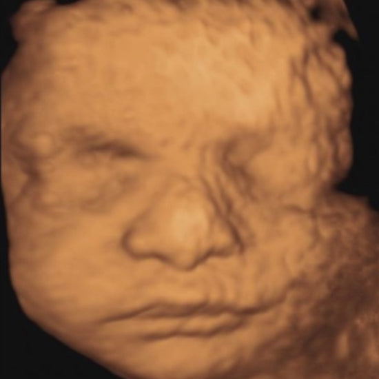 Real View Ultrasound Photo – Babytures